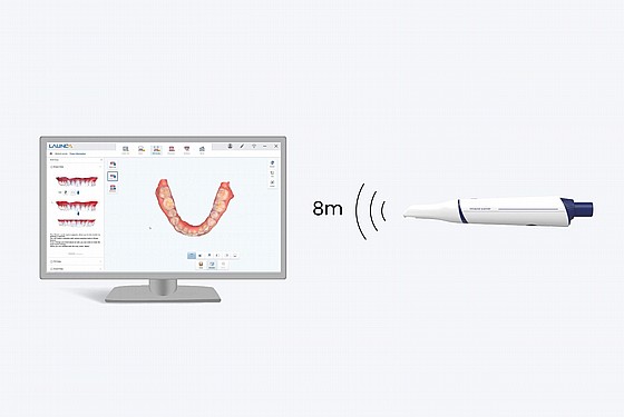 Royal-Dent | רויאל דנט |סורק אינטראורלי אלחוטי LAUNCA Intraoral ...